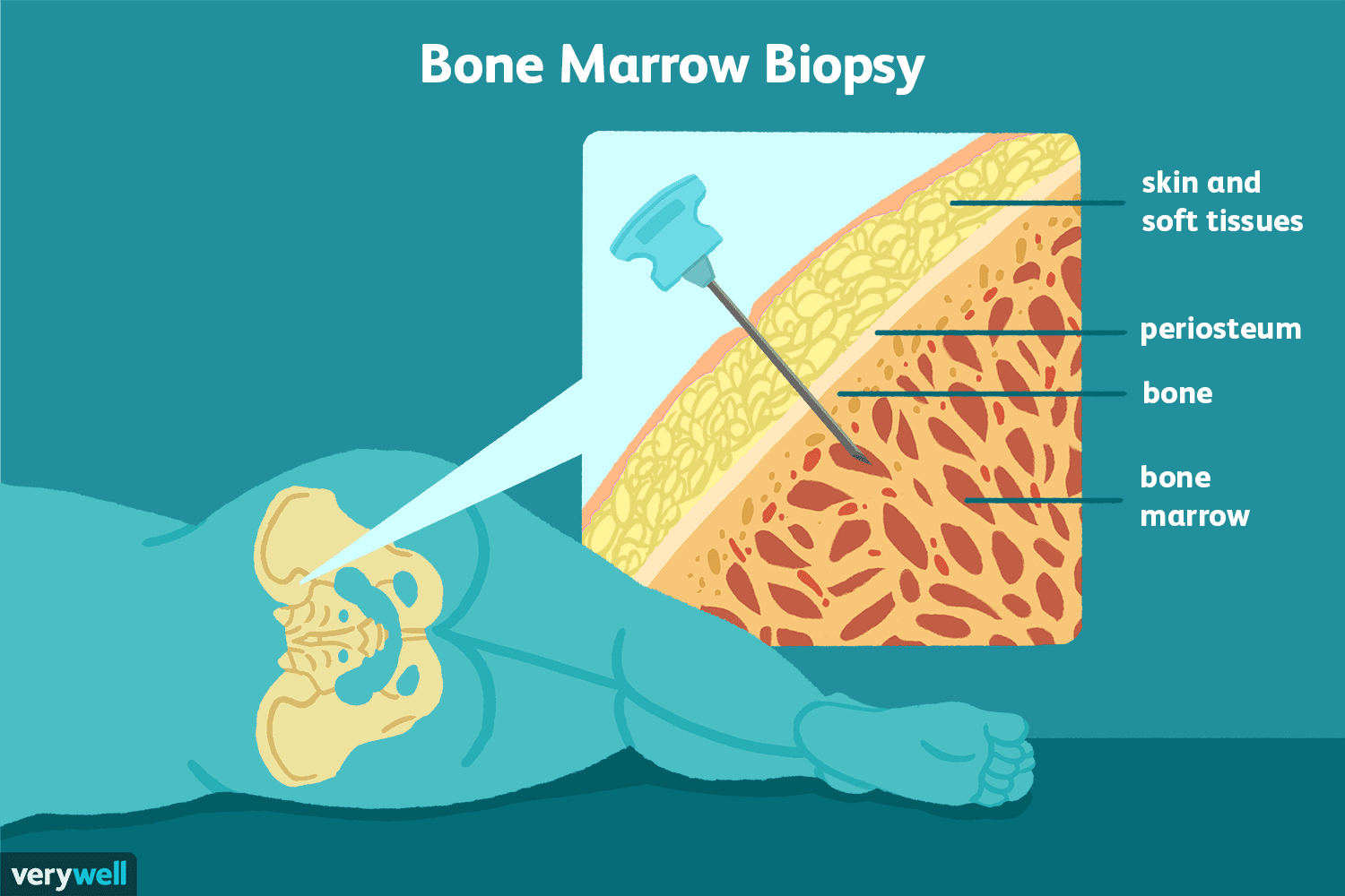 Bone Marrow L G V C u Tr c C m T Bone Marrow Trong C u Ti ng Anh Bone Marrow L G V C u Tr c C m T Bone Marrow Trong C u Ti ng Anh